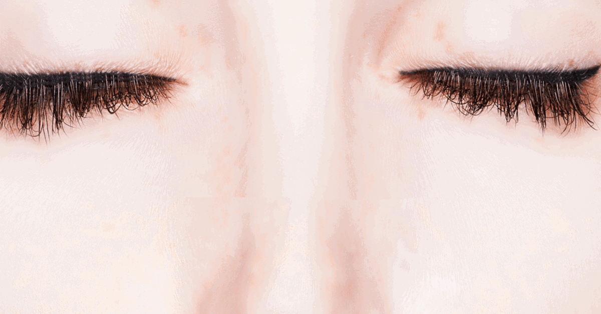 How Can Eye Exercises Help With Myopia
